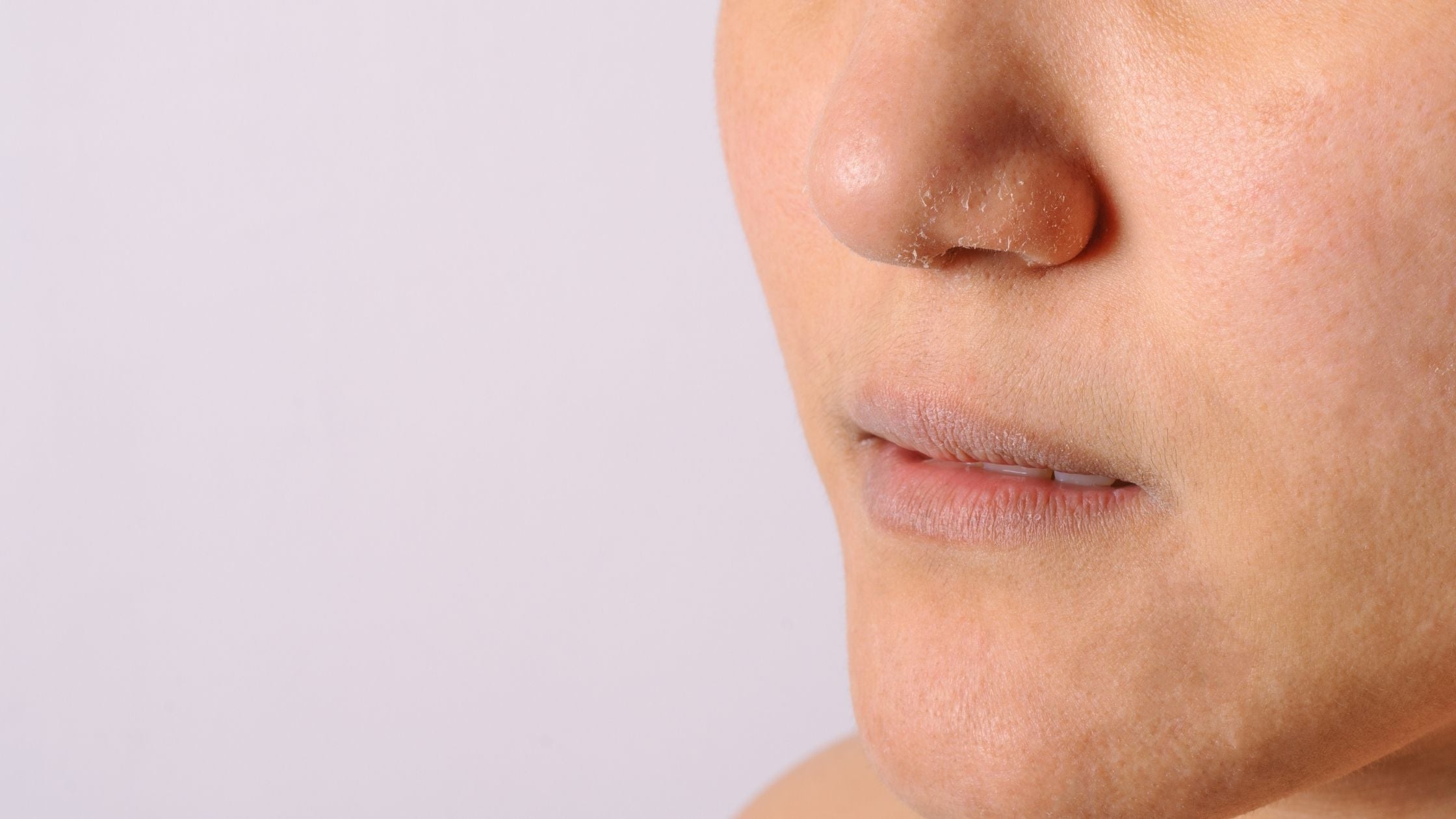 Dry Skin Around Mouth Nose Causes Treatment Minimalist dry-skin-around-mouth-nose-causes-treatment-minimalist
